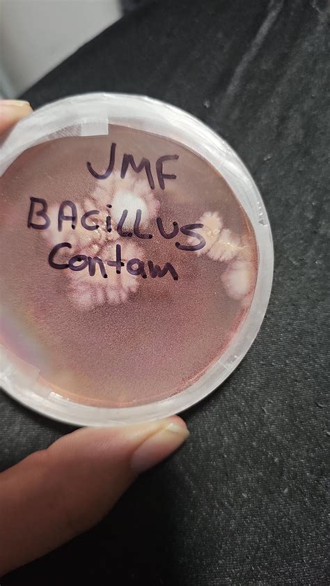 Purposely Contaminated Agar R Shrooms