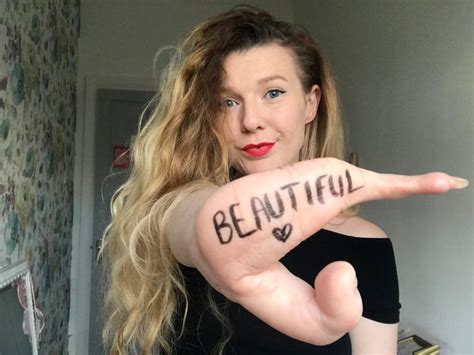 How I Learned To Live With Ectrodactyly