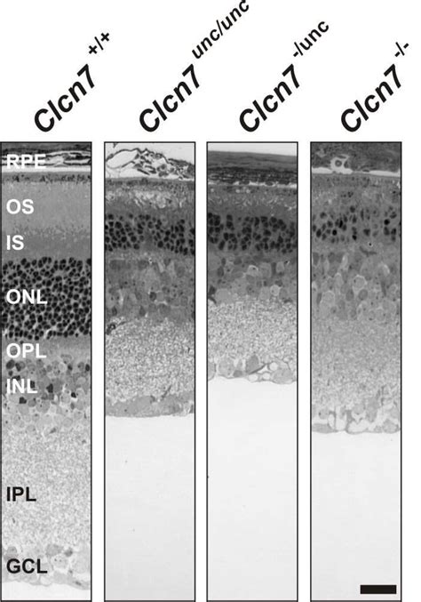 Fig S7 Retinal Degeneration In Clcn7 Uncunc Mice Semi Thin Sections