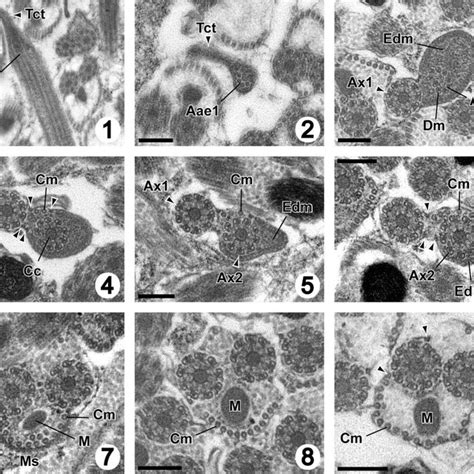 Transmission Electron Micrographs Of Longitudinal 1 And Transverse Download Scientific