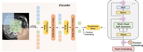Pdf Vision Transformer With Progressive Tokenization For Ct Metal