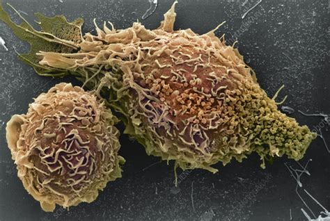 Macrophages Sem Stock Image P2760158 Science Photo Library