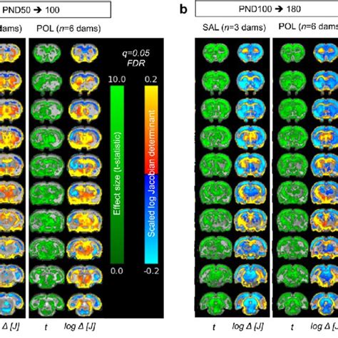 Longitudinal Tensor Based Morphometry Analysis Of Structural Brain