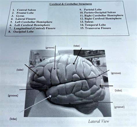 1 Central Sulcus 2 Frontal Lobe 3 Gyrus 4 Lateral Fissure Cerebral