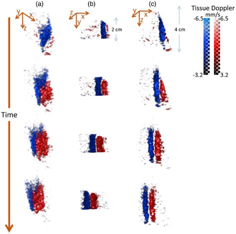Motion Estimation For 3d Shear Wave Imaging Propagation Of A