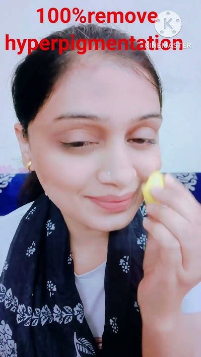 100remove Hyperpigmentation On Facehow To Remove Hyperpigmentation 100remove Hyperpigmentation On Facehow To Remove Hyperpigmentation