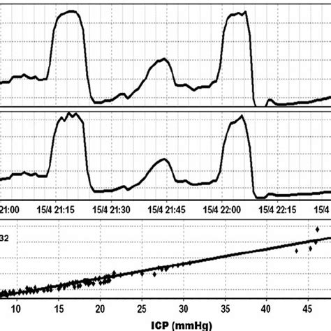 Correlation Between Absolute Values Of Icp During Plateau Wave And Icp Download Scientific