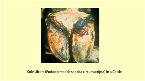 Sole Ulcers In Cattle Pododermatitis Septica Circumscripta