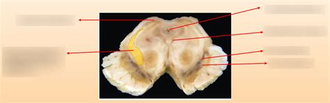 Midbrain Diagram Quizlet