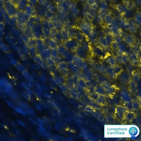 Human Hla Dr Antibody Mab11555 100 Randd Systems