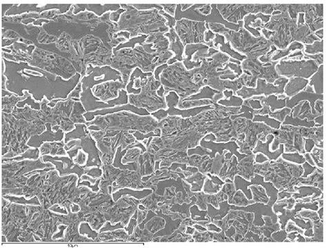 Micrograph Showing The Dual Phase Ferrite Martensite Structure Of