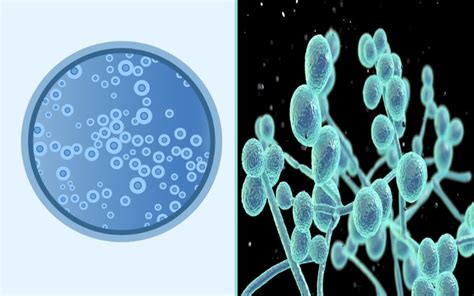 Cryptococcus Neoformans And Candida Albicans 9 Best Difference