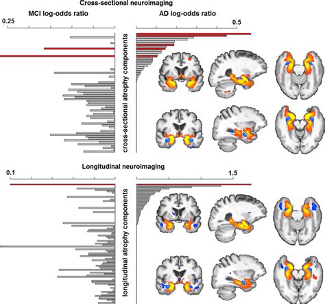 Contribution Of Brain Components In Predicting Subjects Cognitive