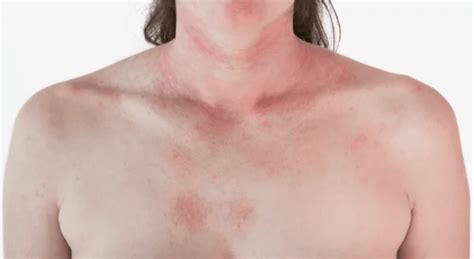 Q What Is Sex Flush CondomDepot Com