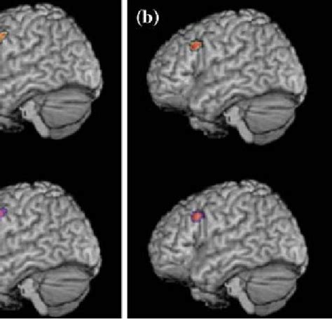 Correlation Of Sex Hormone Levels With Brain Activation During Synonym Download Scientific
