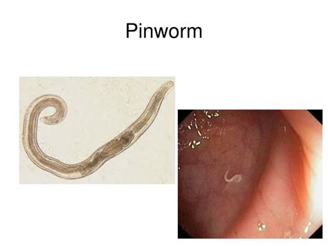 Ppt Parasites Powerpoint Presentation Free Download Id2765995