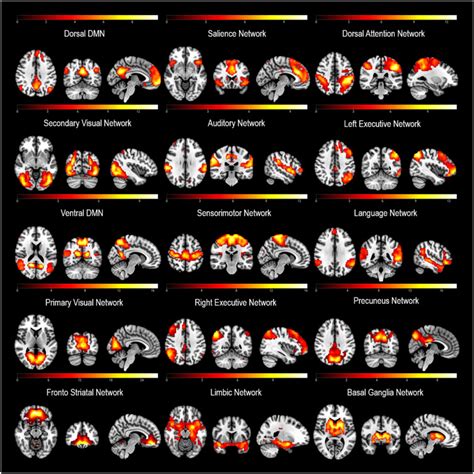 Trait Anxiety Is Associated With Attentional Brain Networks Bohrium