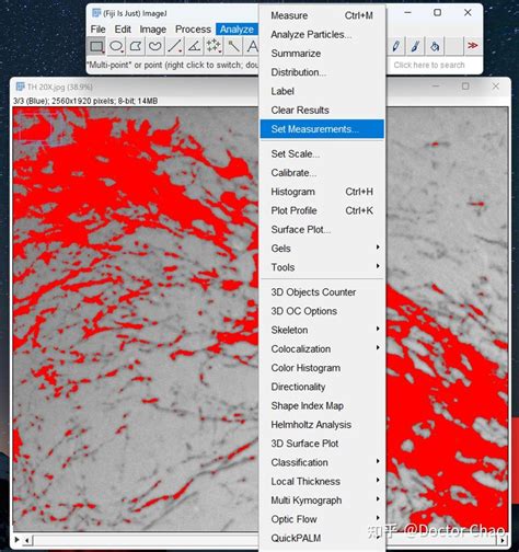 组化片子如何利用image J 进行阳性信号面积占比统计分析 知乎
