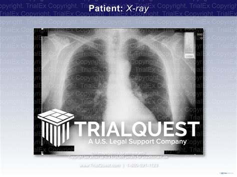 X Ray Trial Exhibits Inc