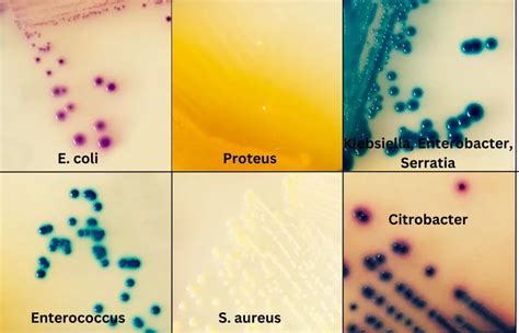 Chromagar Composition Principle Preparation Results Uses