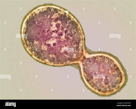 Cryptococcus Cell Dividing Coloured Transmission Electron Micrograph TEM Of The Asexual