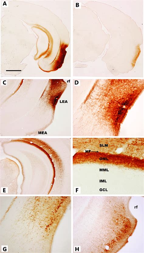 Pathologic Human Tau In The Mouse Perforant Pathway Mimics Braak Stage