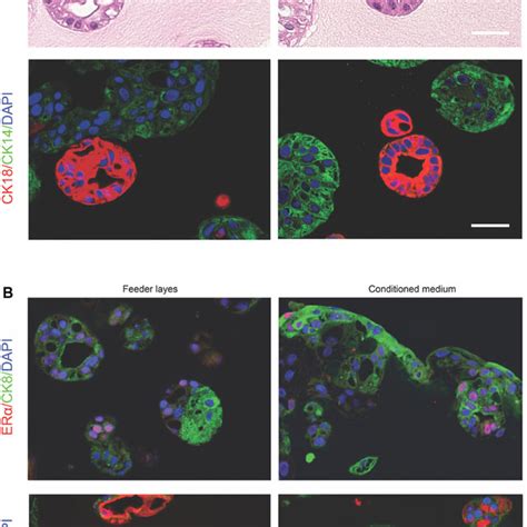 Conditional Reprogrammed Epithelial Cells In 3d Culture A Top Download Scientific Diagram