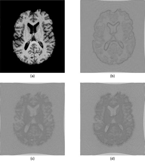 Two Dimensional Grid Image Based On Brain Mri Images Brightness And Download Scientific Diagram