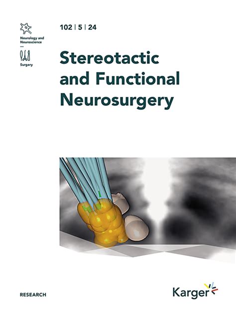 Electrical And Magnetic Neuromodulation Technologies And Brain Computer Interfaces Ethical