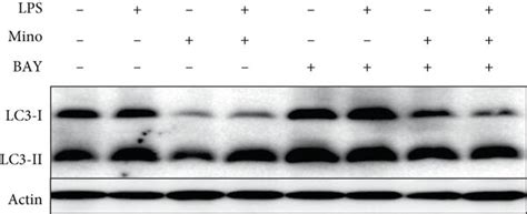 An Intimate Crosstalk Between The Nf κb Pathway And Autophagy Flux In
