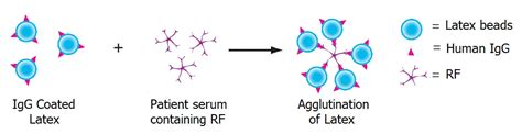 Rheumatoid Factor Rf Test Principle Procedure Interpretation And Clinical Significance