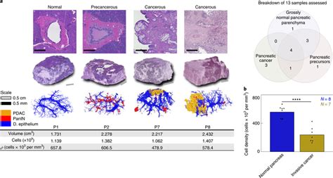Interpatient Pancreas Analysis From Cm Scale To Single Cell Download Scientific Diagram