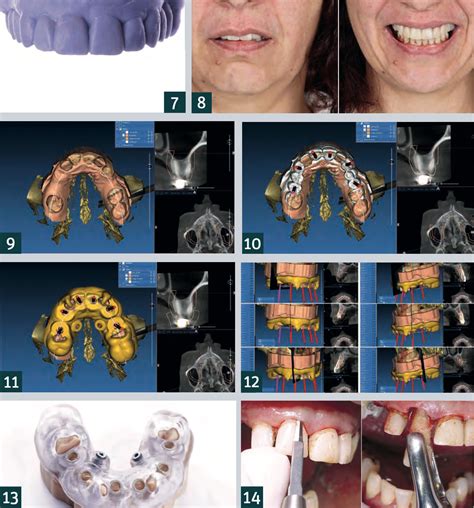 Testimonianza Di Michael Weiland Corsi Teorici E Pratici Di