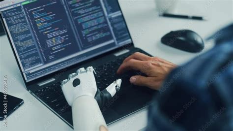 Over Shoulder Hands Close Up Programmer With Disability Using Prosthetic Arm To Work On Laptop