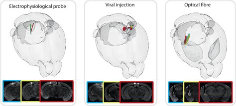 Whole Brain Microscopy Analysis