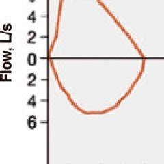 Flow Volume Loop FVC Indicates Forced Vital Capacity Download Scientific Diagram