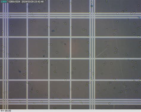 Infectioncell Object Detection Dataset And Pre Trained Model By Aiml