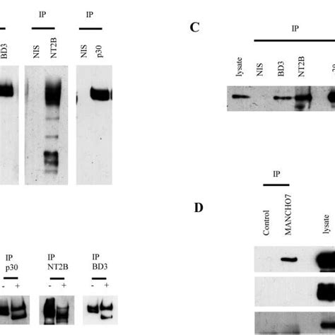 Modular Structure Of Polycystin 1 And Polycystin 2 Showing The