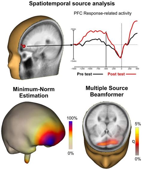 Source Analysis Of The Prefrontal Activity Using Three Different