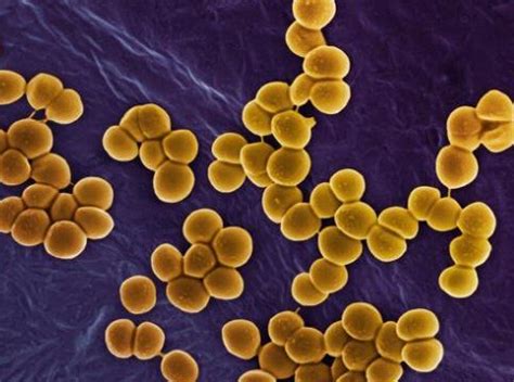细菌类家禽疾病葡萄球菌病 广东新理想生物制药有限公司