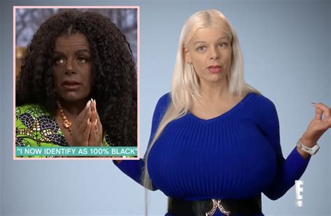 Martina Big Vorher Nachher Bilder — Yongnam