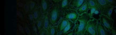 Cellular Imaging Systems Imagexpress High Content Imaging And Analysis Digital And Confocal Microscopy