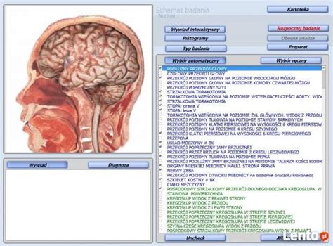 The Oberon System Faredro