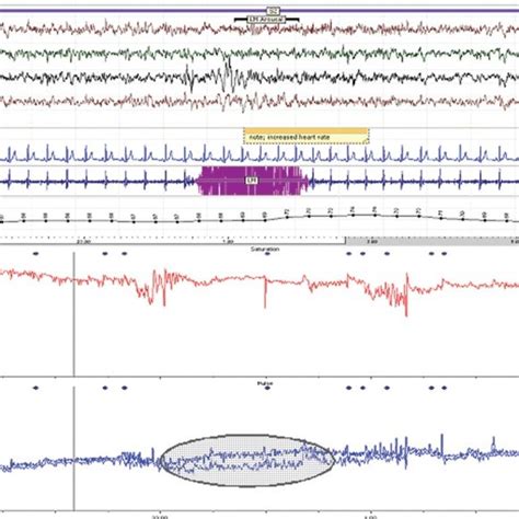 Demonstration Of Heart Pulse Rate Variability Related To Arousal A An Download Scientific