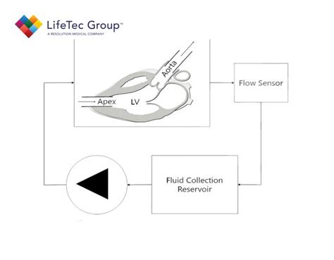 Cardiac Magnetic Resonance Velocity Mapping Lifetec Group