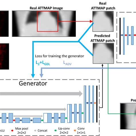 Deep Learning Based Attenuation Map Generation For Myocardial Perfusion