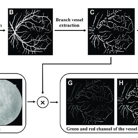 region of interest extraction process a original color fundus