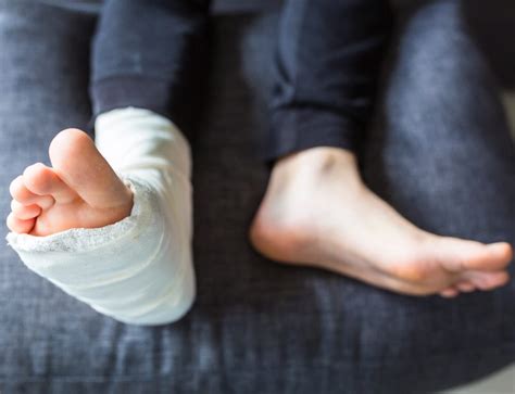 Tibia Fracture Healing Time What To Expect Fracture Healing