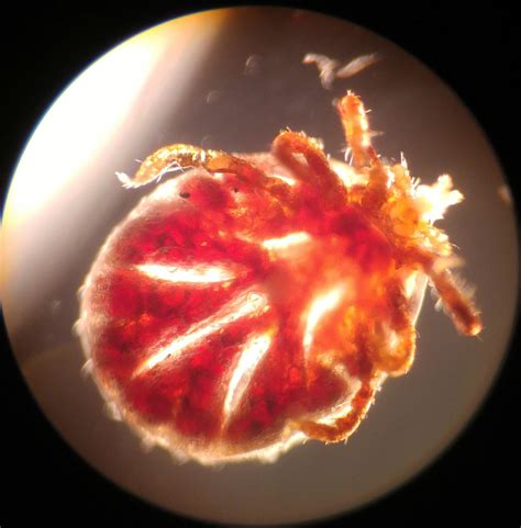 [nj] I Found This Bug Attached To My Genitals Please Help 100x