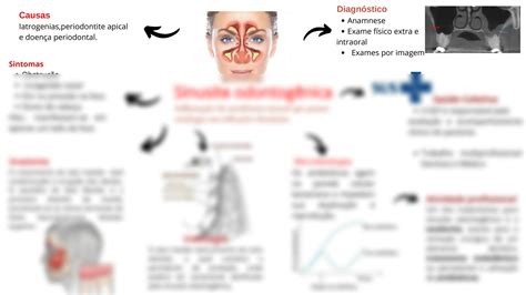 Solution Sinusite Odontog Nica Mapa Mental Studypool